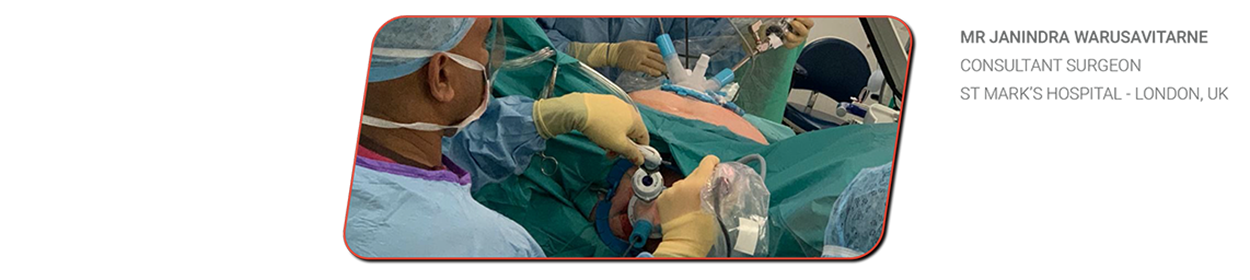 TATME TAMIS - Operating Room System